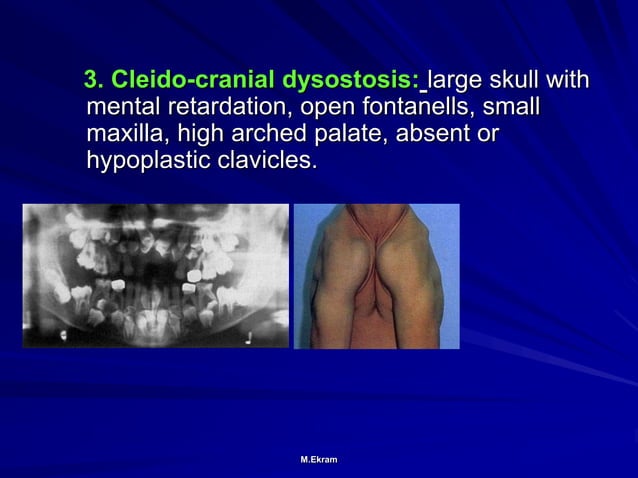 Radiographic assessment of teeth developmental anomalies | PPT