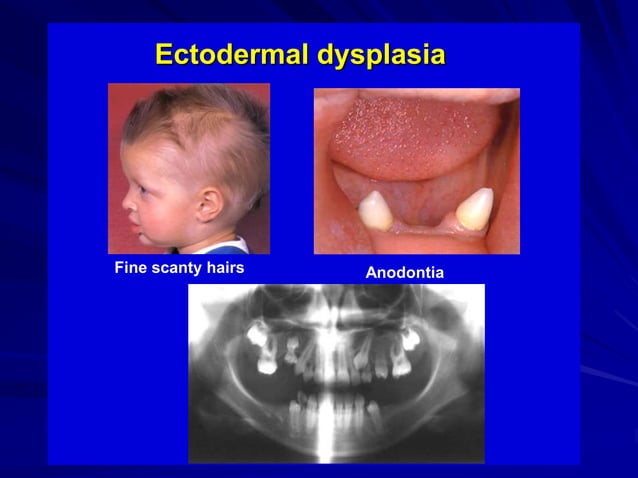 Radiographic assessment of teeth developmental anomalies | PPT
