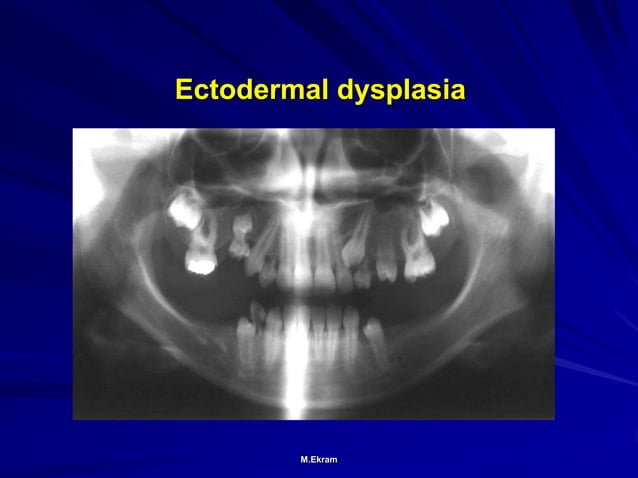 Radiographic assessment of teeth developmental anomalies | PPT