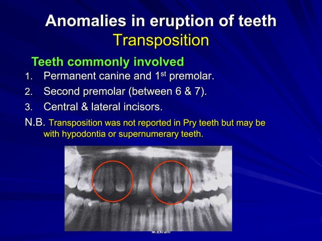 Radiographic assessment of teeth developmental anomalies | PPT