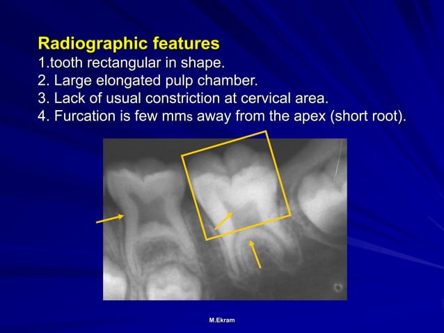 Radiographic assessment of teeth developmental anomalies | PPT
