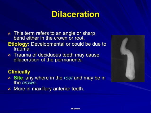Radiographic assessment of teeth developmental anomalies | PPT