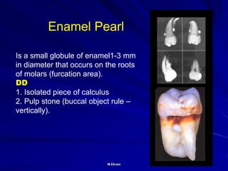 Radiographic assessment of teeth developmental anomalies | PPT