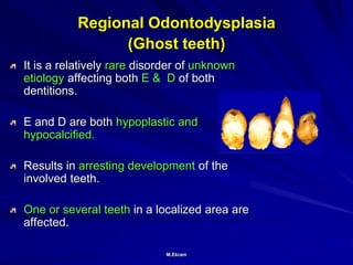 Radiographic assessment of teeth developmental anomalies | PPT