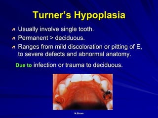 Radiographic assessment of teeth developmental anomalies | PPT