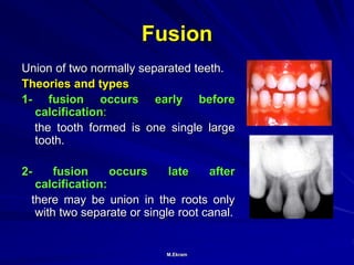Radiographic assessment of teeth developmental anomalies | PPT