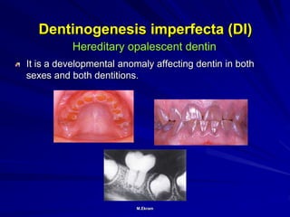 Hereditary Brown Opalescent Dentin Radiograph
