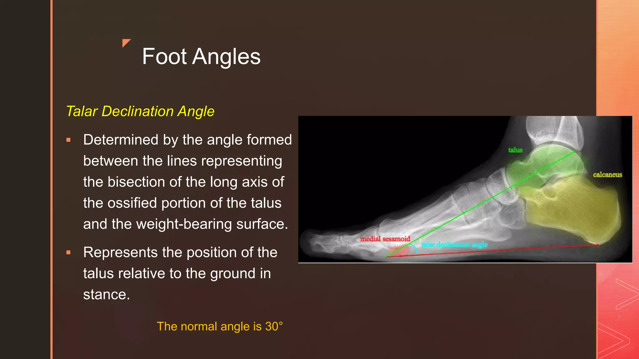 Radiographic assessment of pediatric foot alignment | PPTX