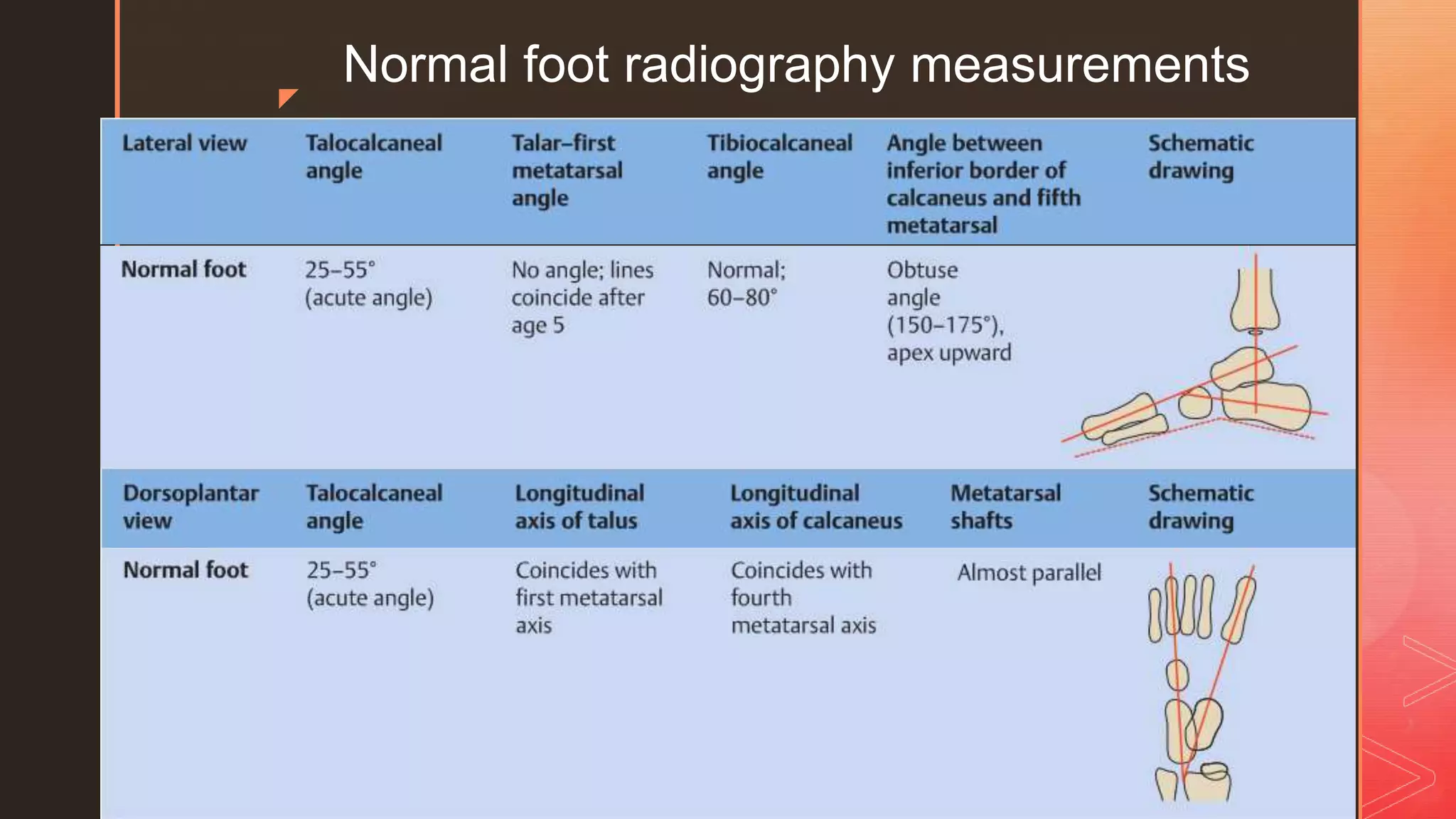 Radiographic assessment of pediatric foot alignment | PPTX