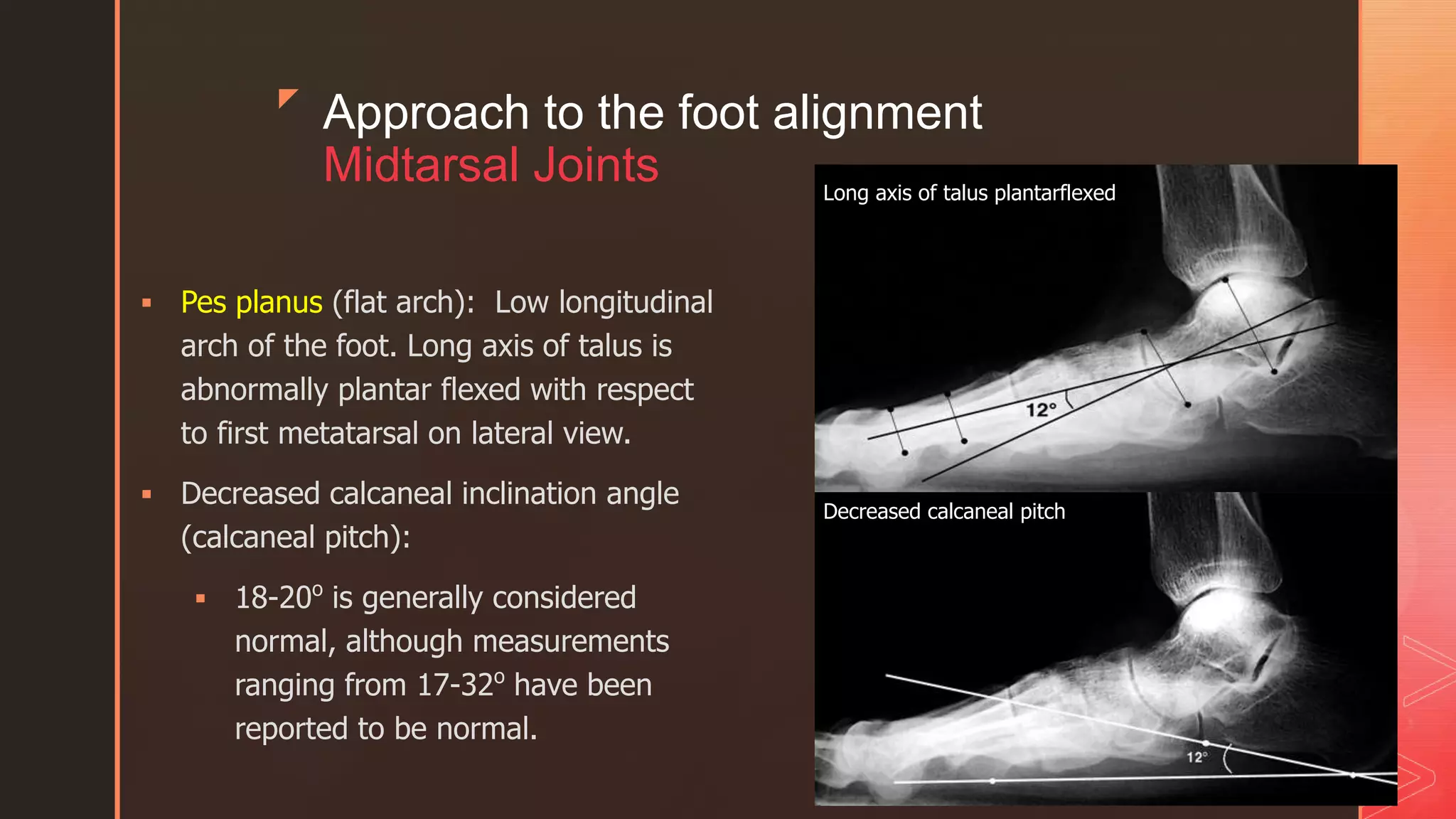 Radiographic assessment of pediatric foot alignment | PPTX
