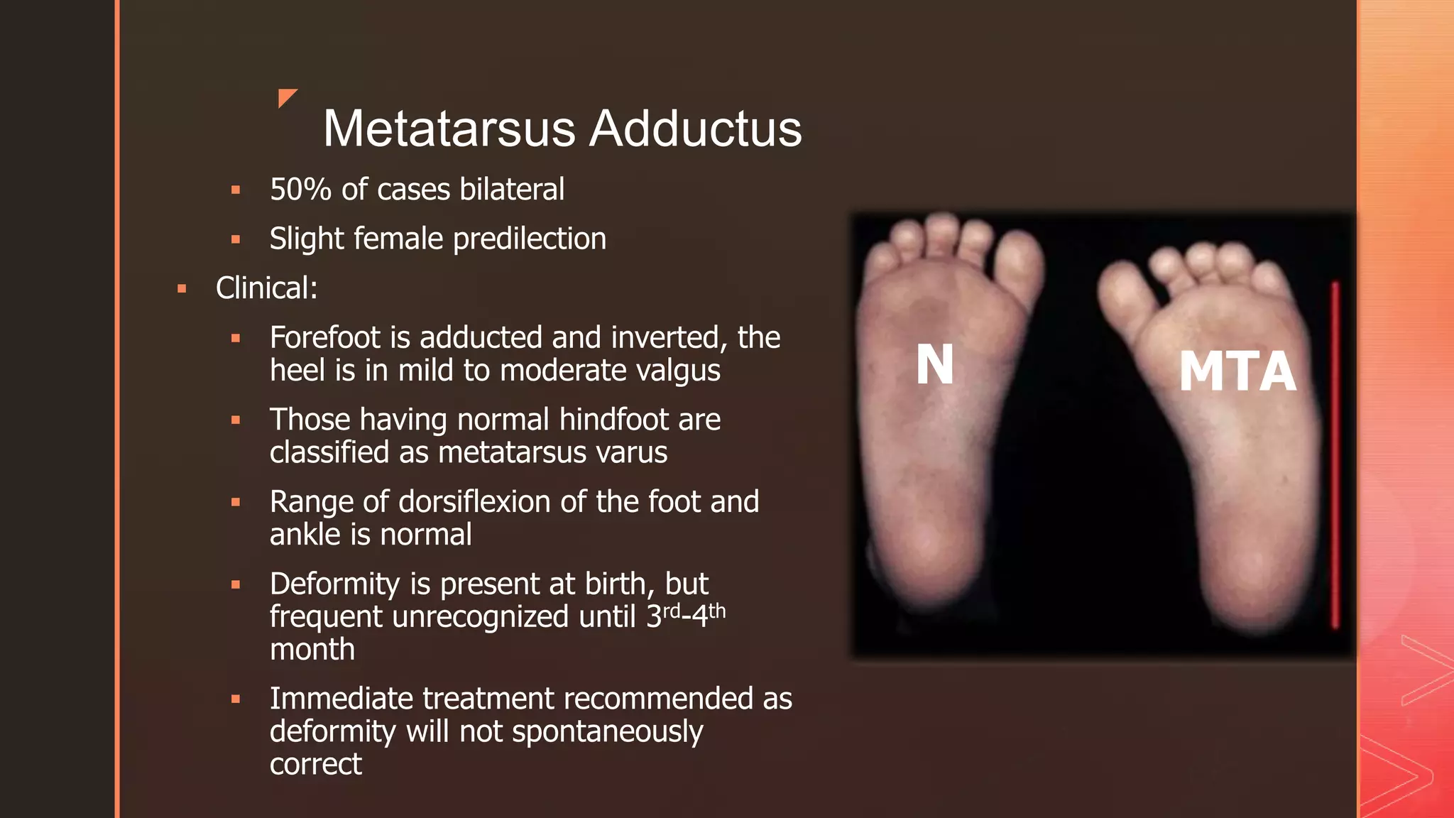 Radiographic assessment of pediatric foot alignment | PPTX