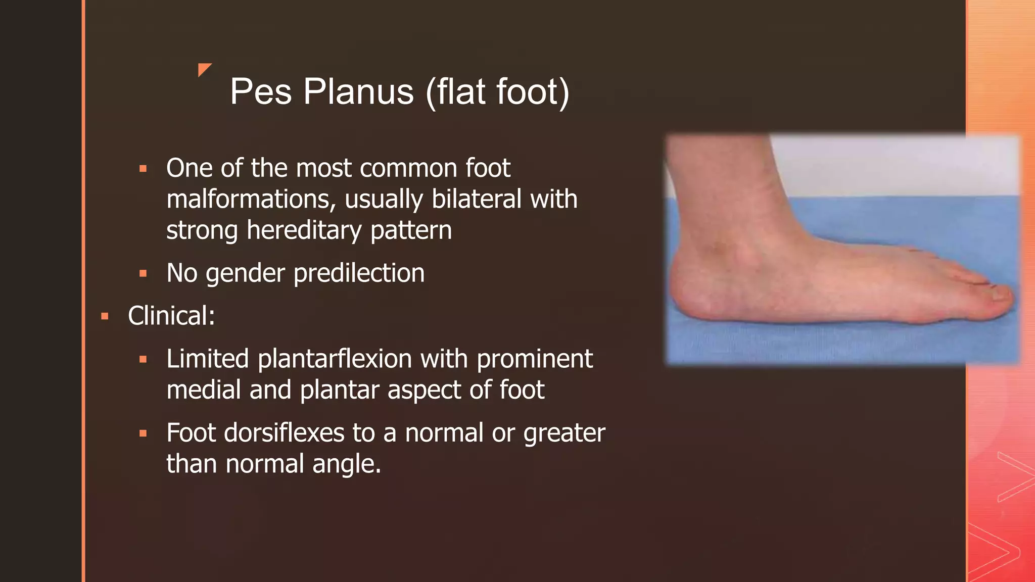 Radiographic assessment of pediatric foot alignment | PPTX