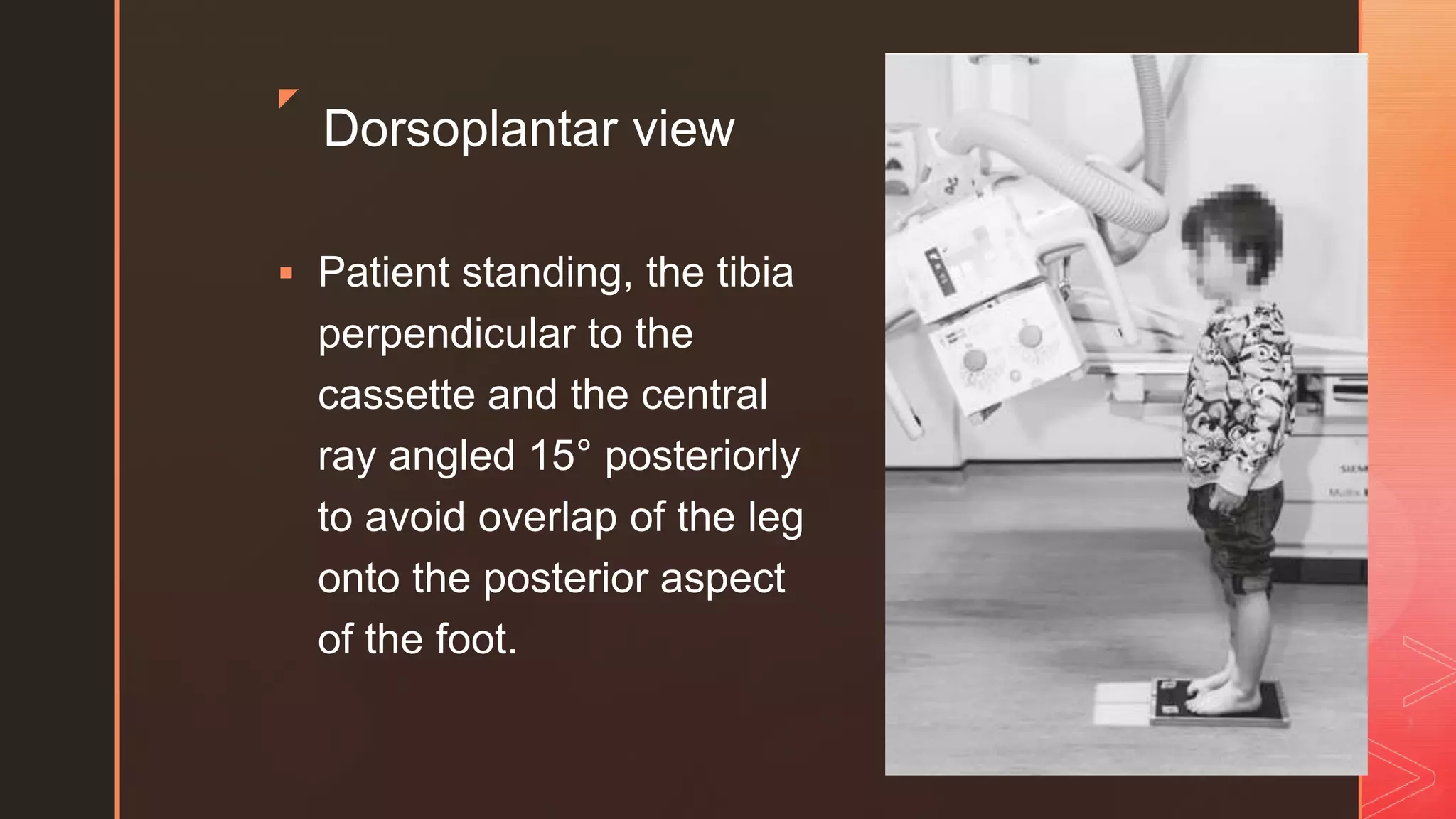 Radiographic assessment of pediatric foot alignment | PPTX
