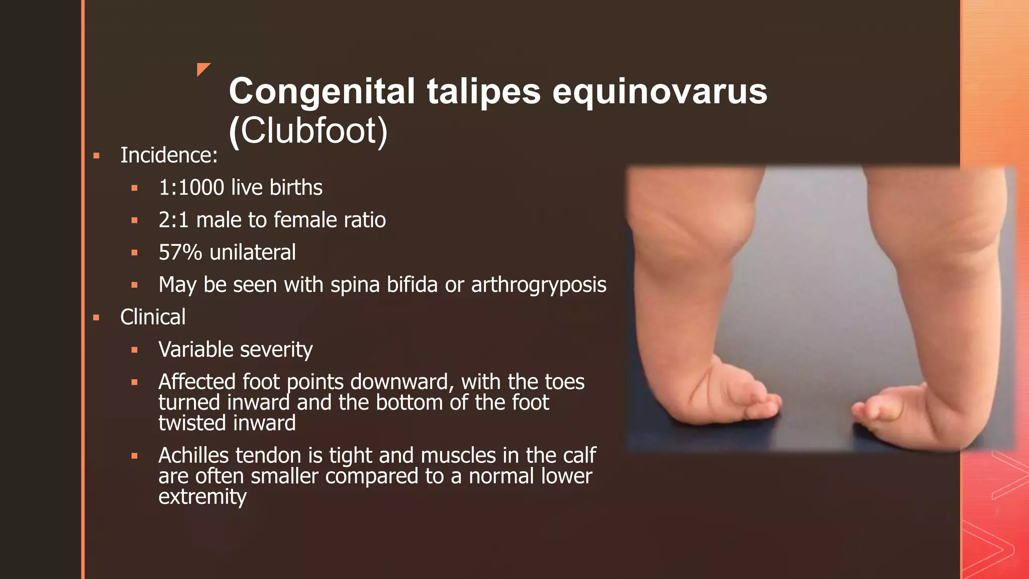 Radiographic assessment of pediatric foot alignment | PPTX