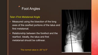Radiographic assessment of pediatric foot alignment | PPTX