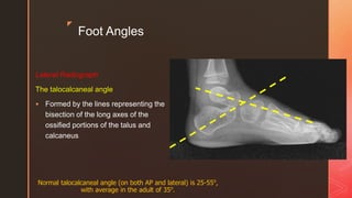 Radiographic assessment of pediatric foot alignment | PPTX