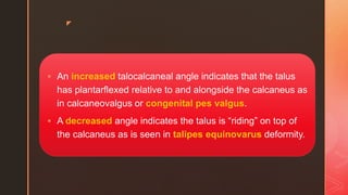 Radiographic assessment of pediatric foot alignment | PPTX