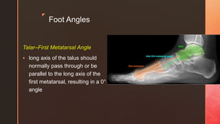 Radiographic assessment of pediatric foot alignment | PPTX