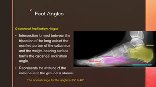 Radiographic assessment of pediatric foot alignment | PPTX