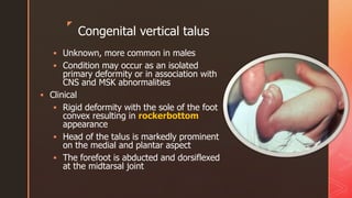 Radiographic assessment of pediatric foot alignment | PPTX