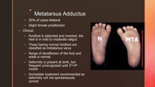 Radiographic assessment of pediatric foot alignment | PPTX