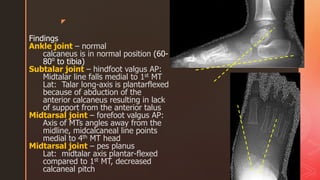 Radiographic assessment of pediatric foot alignment | PPTX