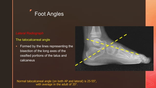 Radiographic assessment of pediatric foot alignment