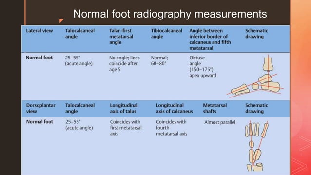 Radiographic assessment of pediatric foot alignment