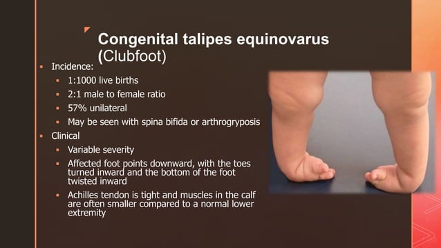 Radiographic assessment of pediatric foot alignment