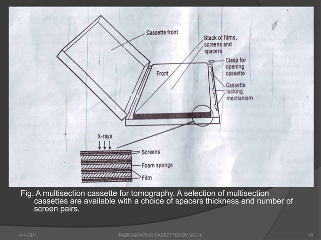 Radiographic cassettes | PPSX | Cameras and Camcorders | Consumer ...