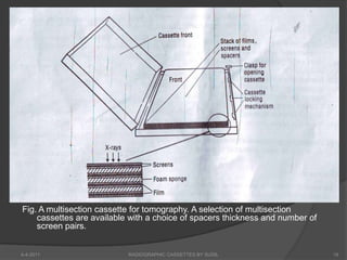 Radiology Film Screen Cassette