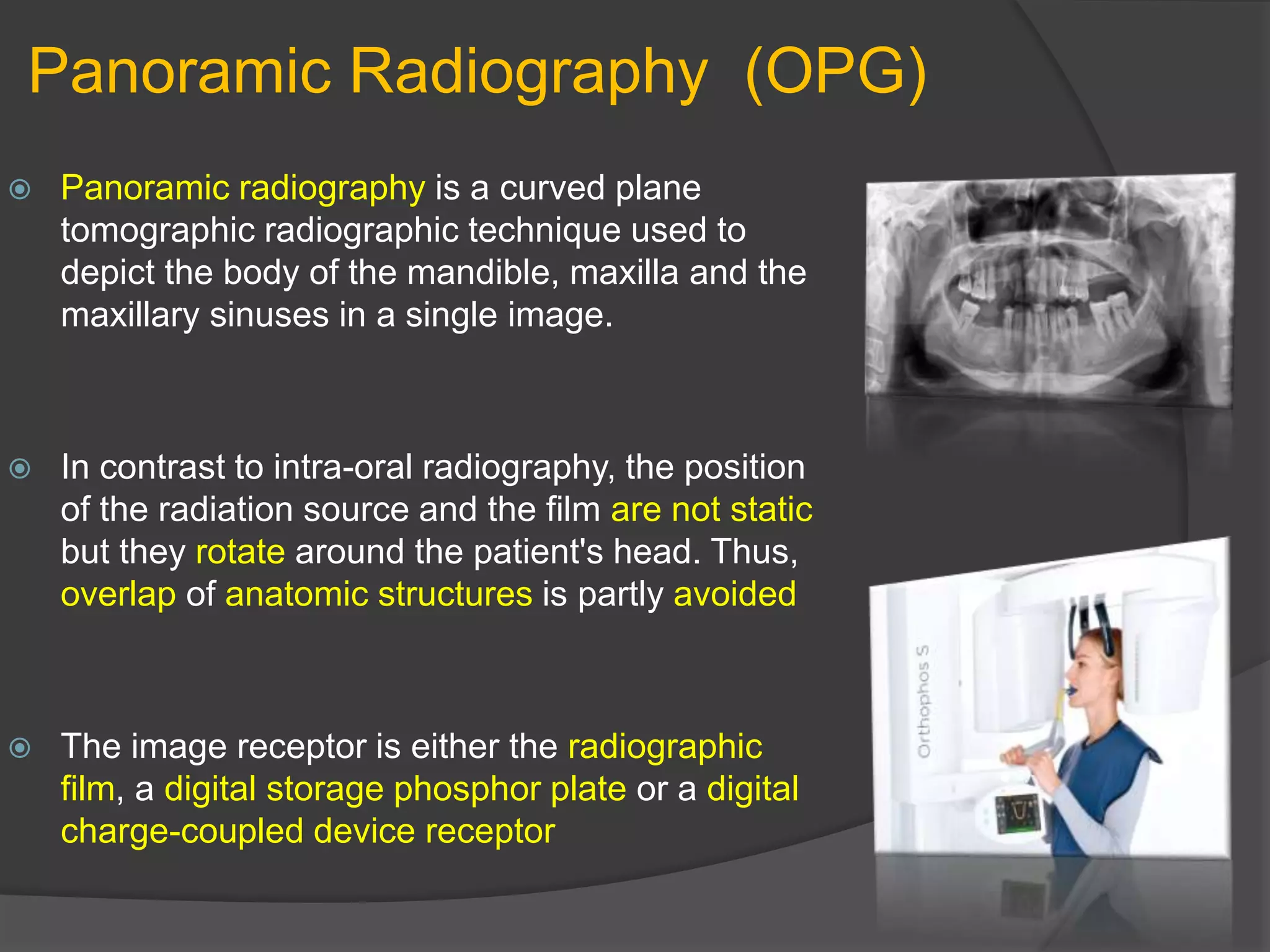 Radiographic considerations in dental implants | PPTX