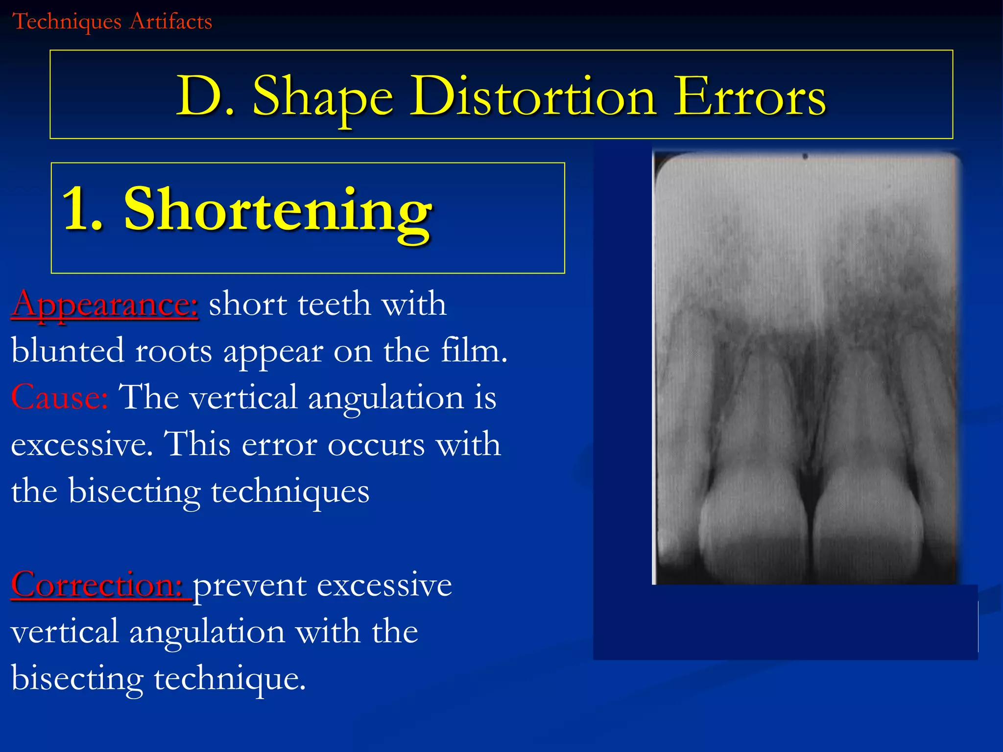 radiographic errors.ppt