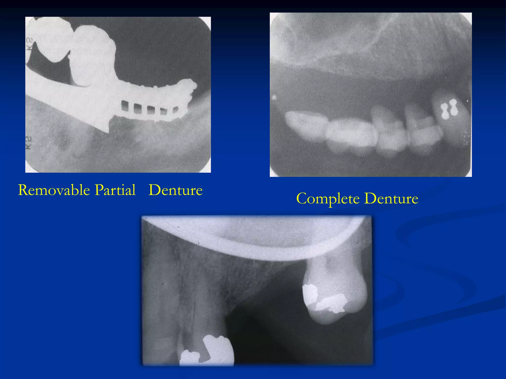 radiographic errors.ppt