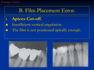 radiographic errors.ppt