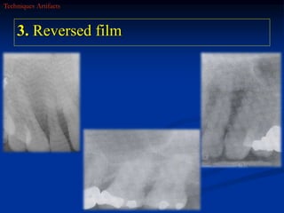 radiographic errors.ppt
