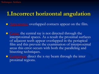 radiographic errors.ppt