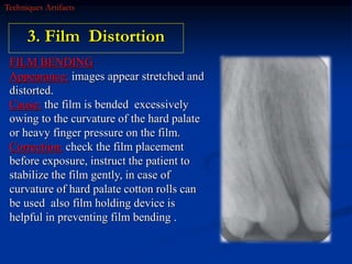 radiographic errors.ppt