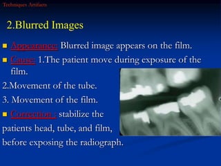 radiographic errors.ppt