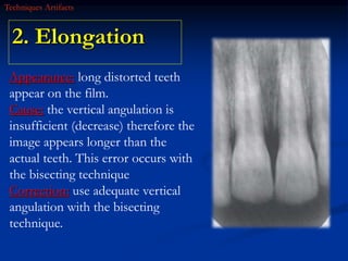 radiographic errors.ppt