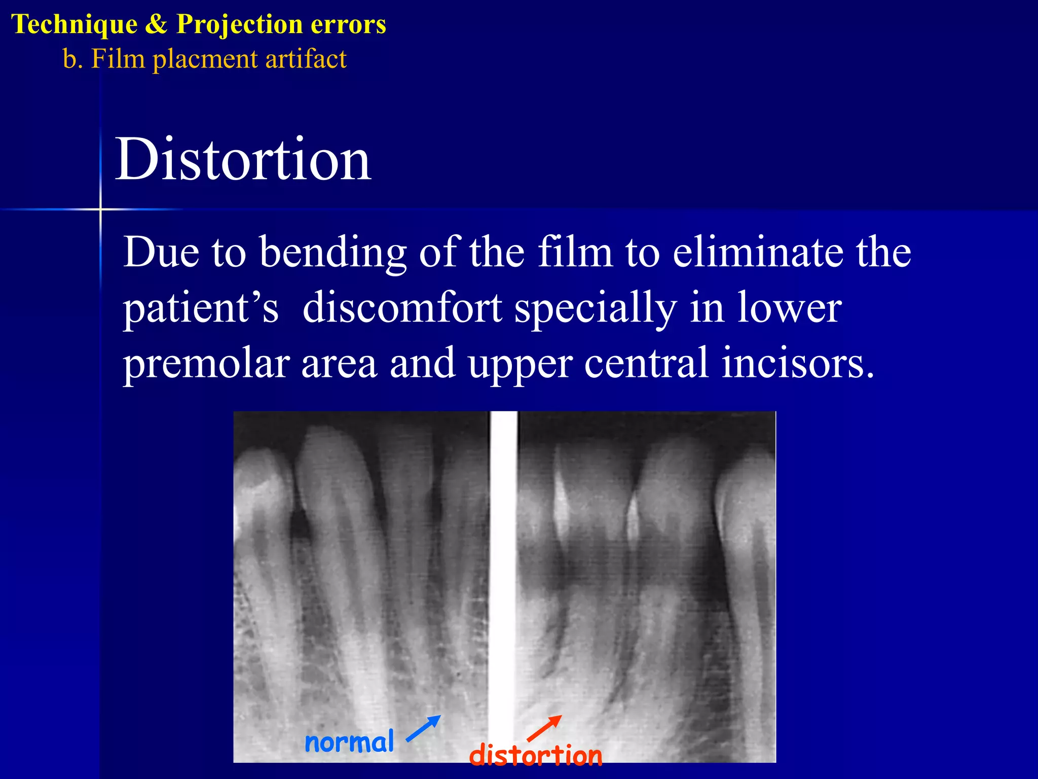 Radiographic errors and artifacts | PPTX