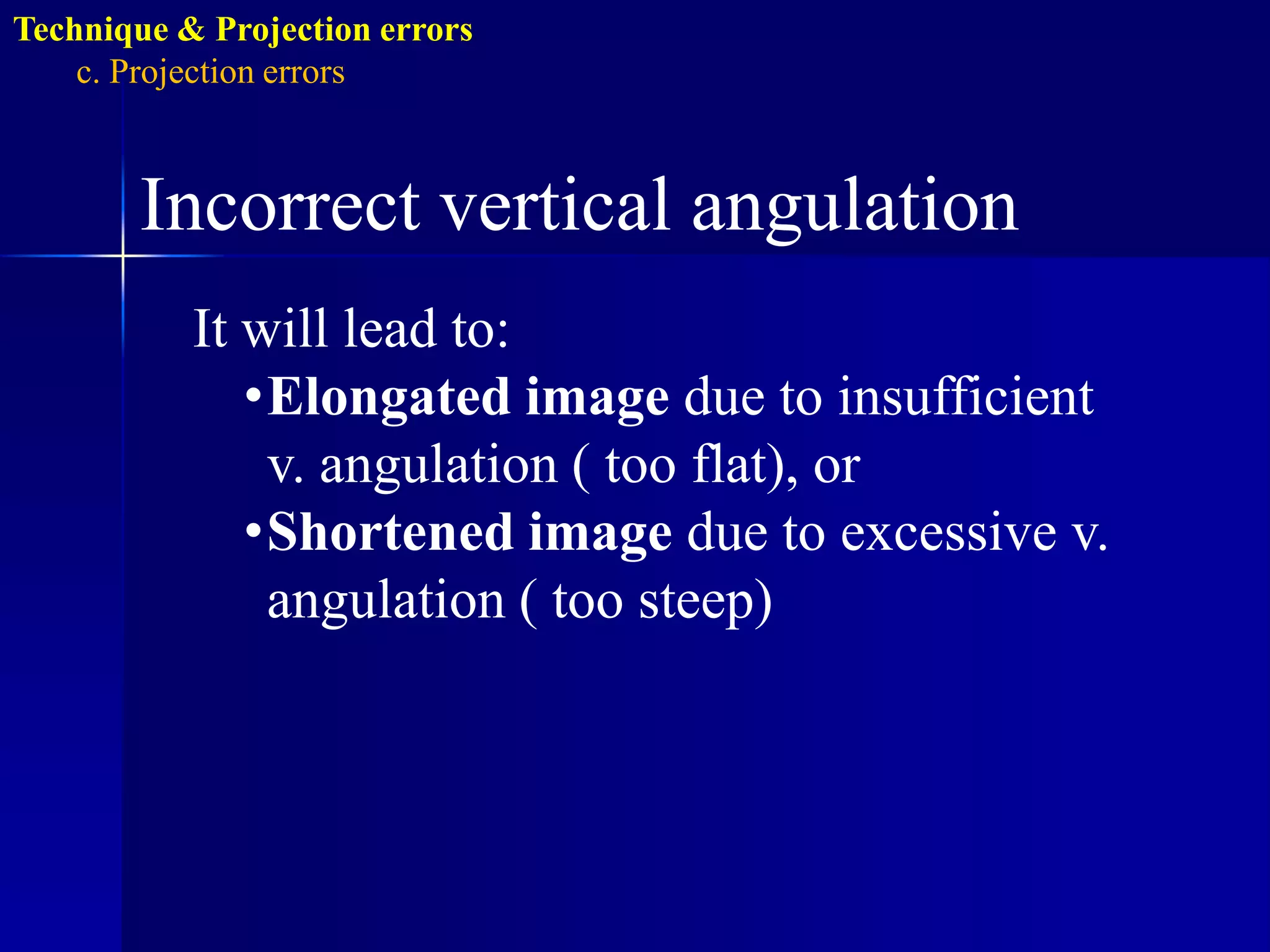 Radiographic errors and artifacts | PPTX