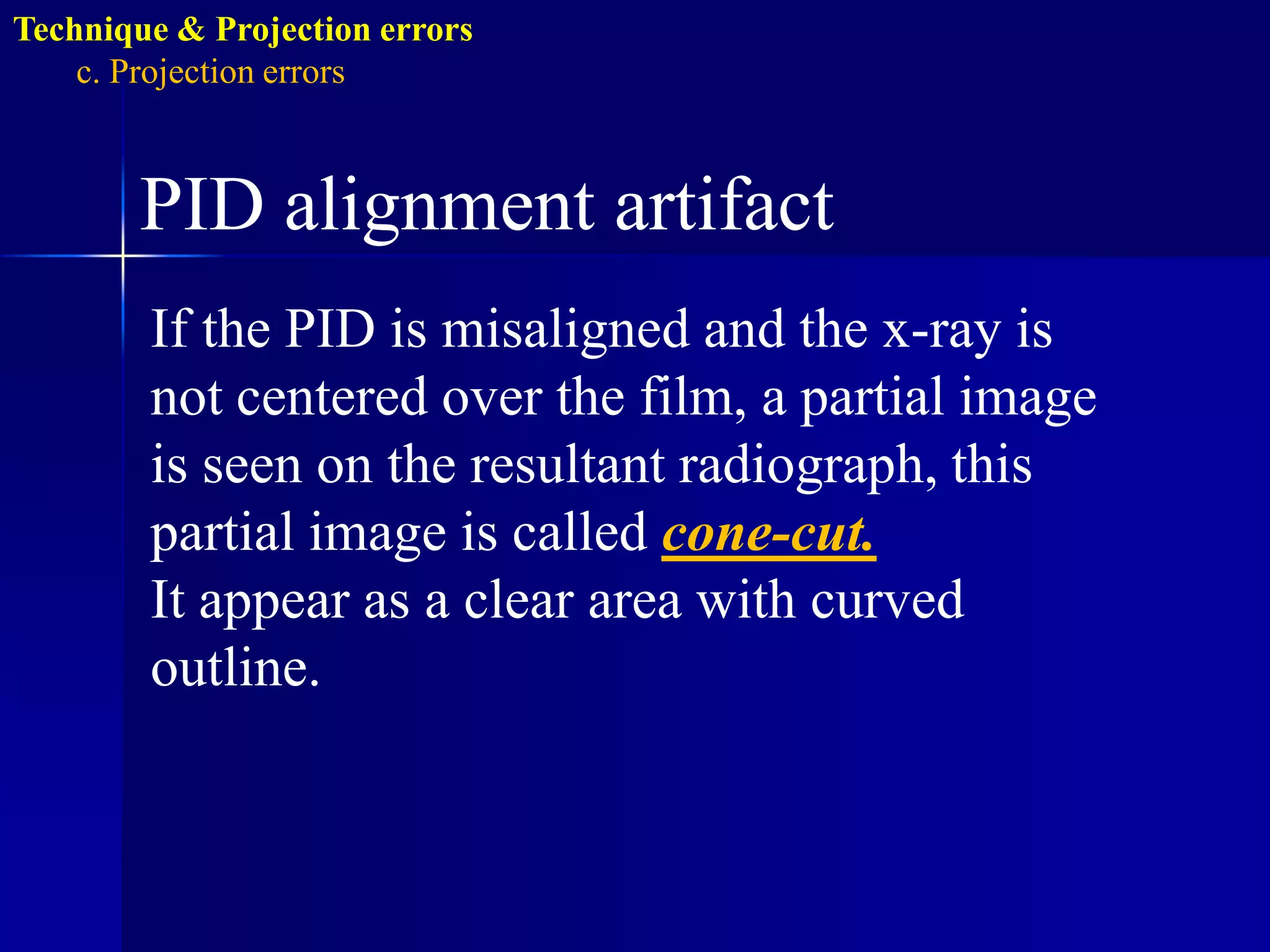 Radiographic errors and artifacts | PPTX