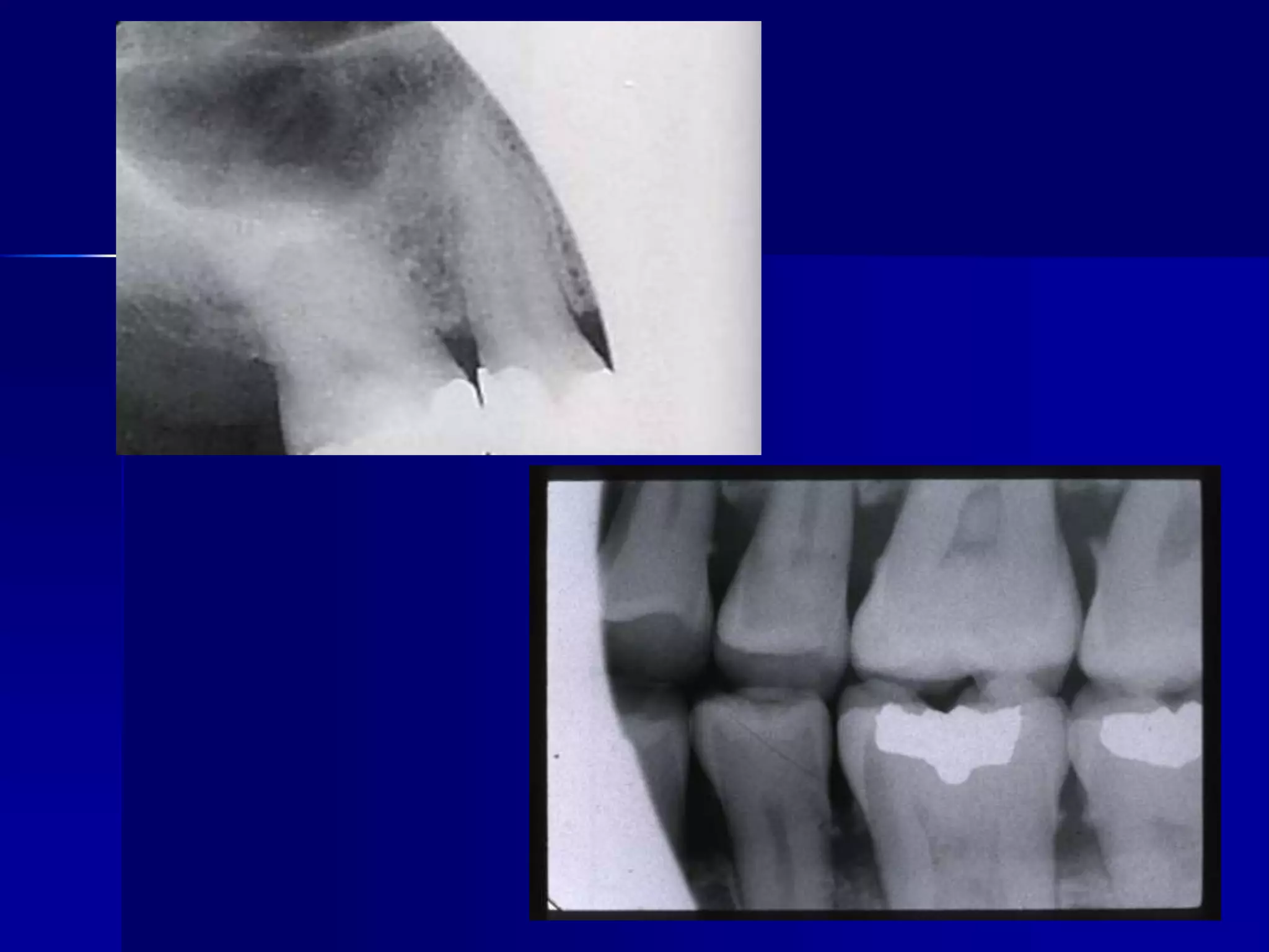 Radiographic errors and artifacts | PPTX