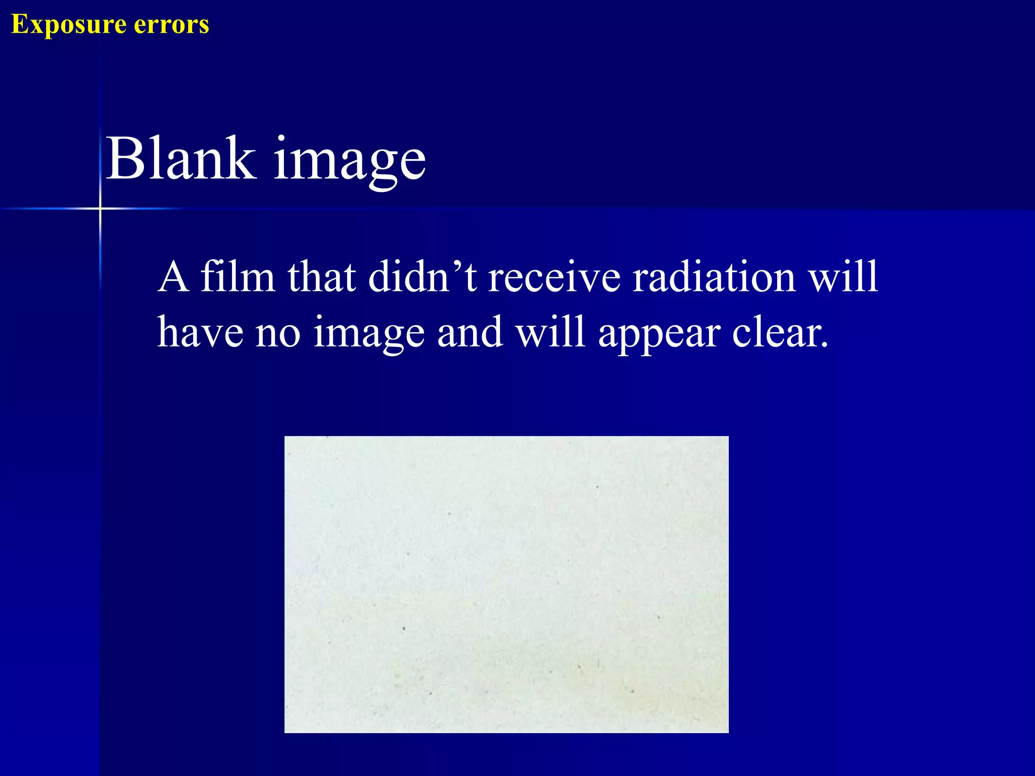 Radiographic errors and artifacts | PPTX