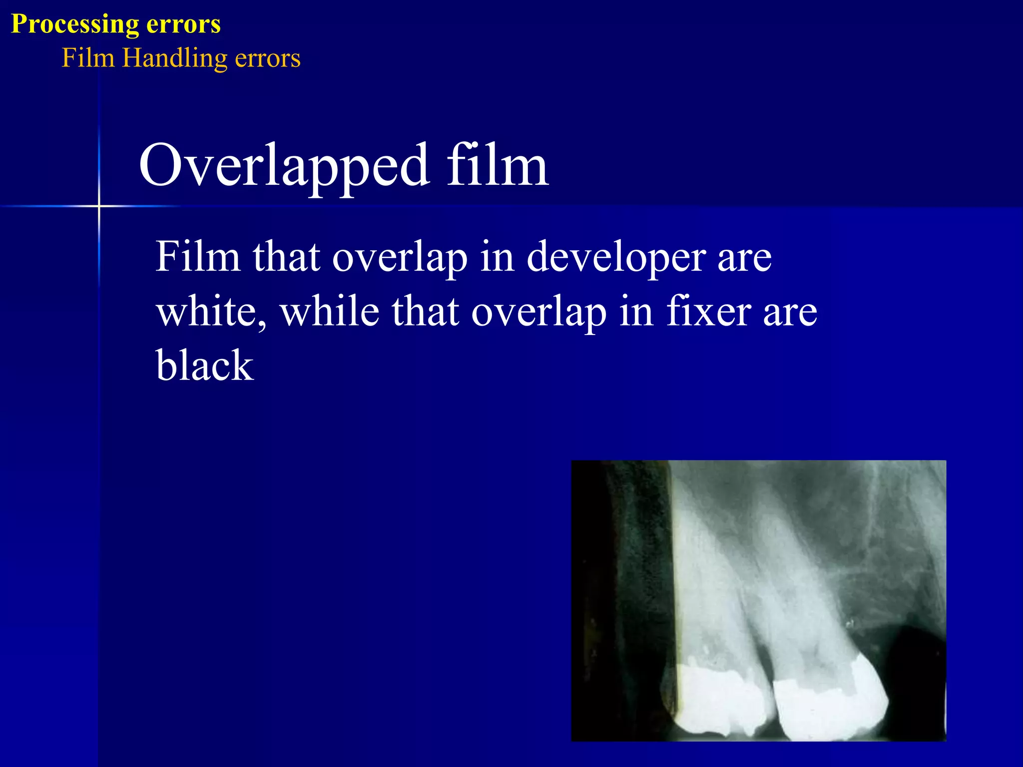 Radiographic errors and artifacts | PPTX