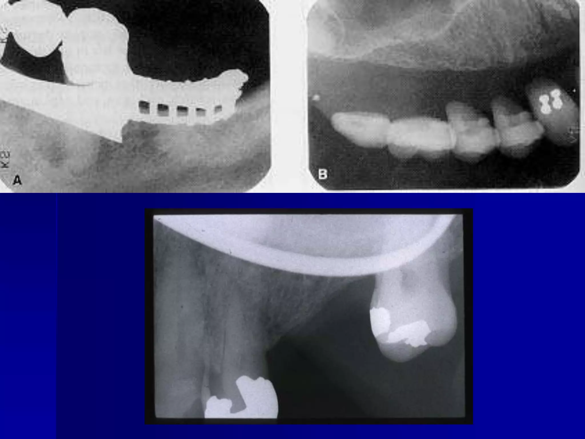 Radiographic errors and artifacts | PPTX