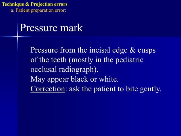 Radiographic errors and artifacts | PPTX | Photo Editing Software ...