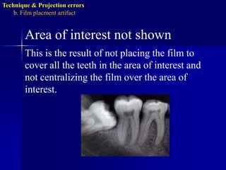Dental Radiology Errors