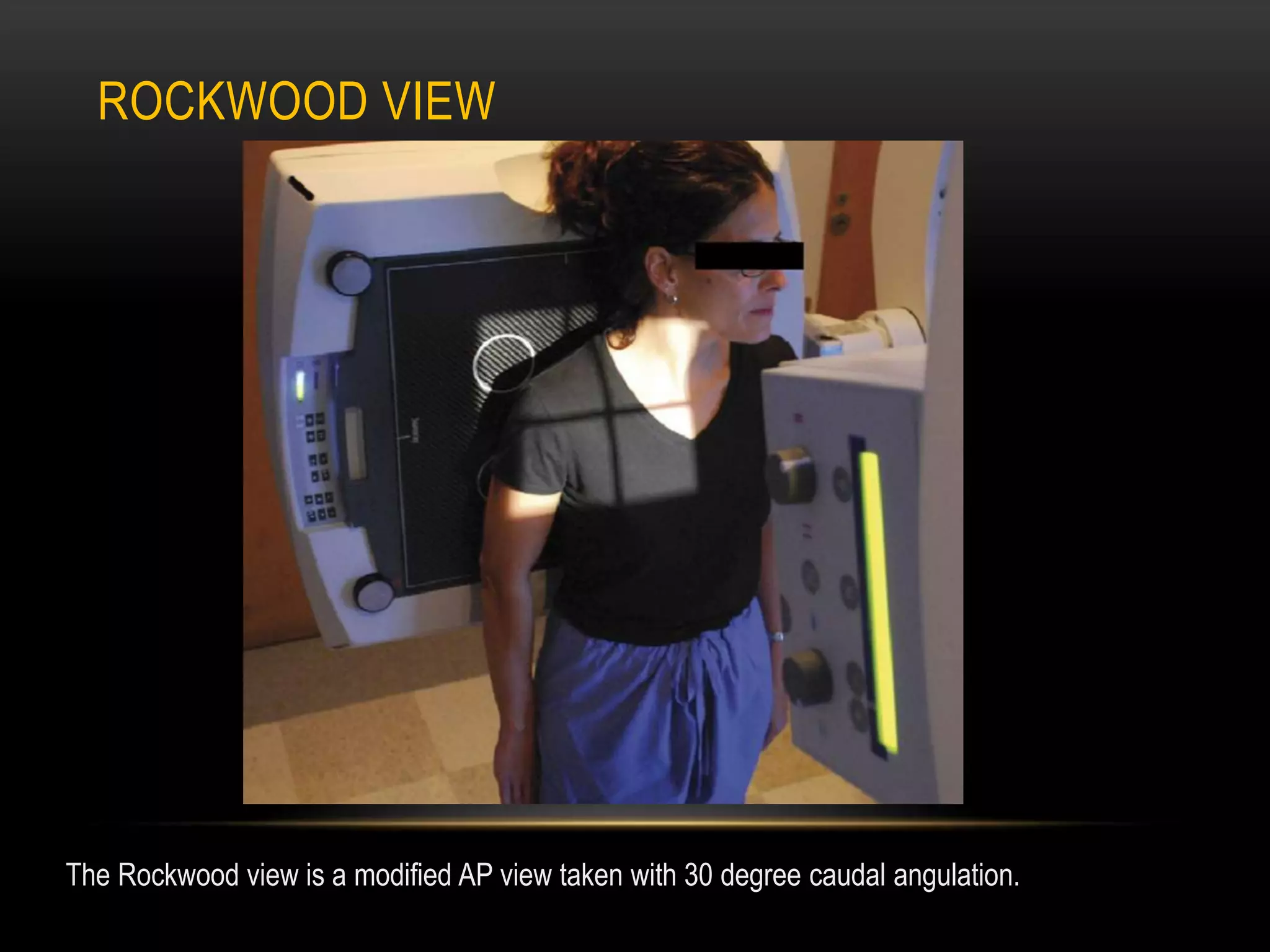 Radiographic evaluation of shoulder | PPTX